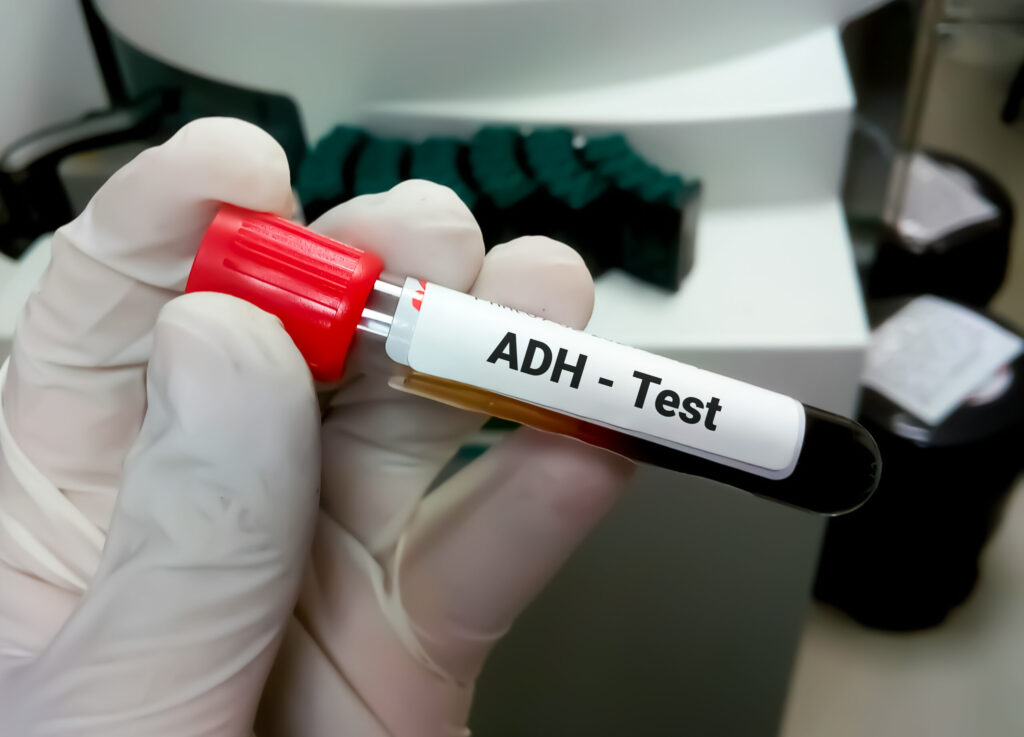 ADH Test (Antidiuretic Hormone Test)