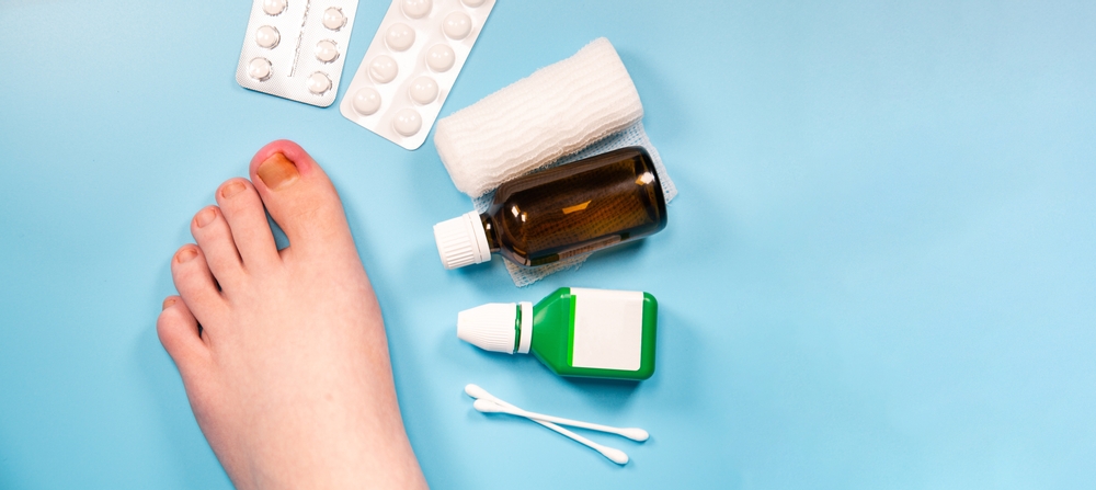 Comparing Nail Excision Vs. Conservative Treatments For Ingrown Toenails