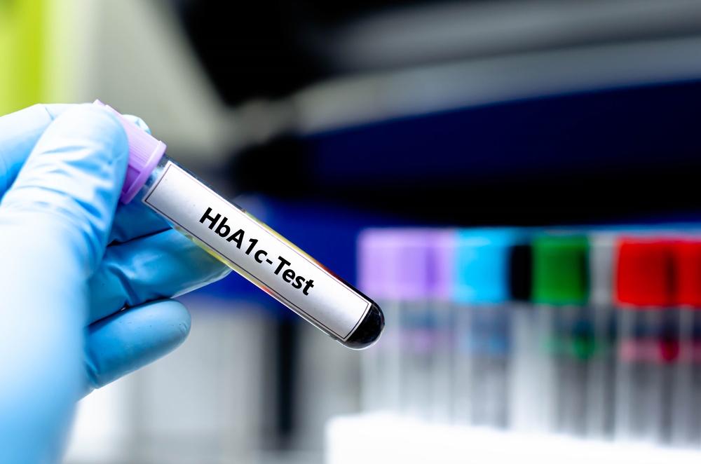 What Is The A1C Test? 5 Key Facts That Could Save Your Health