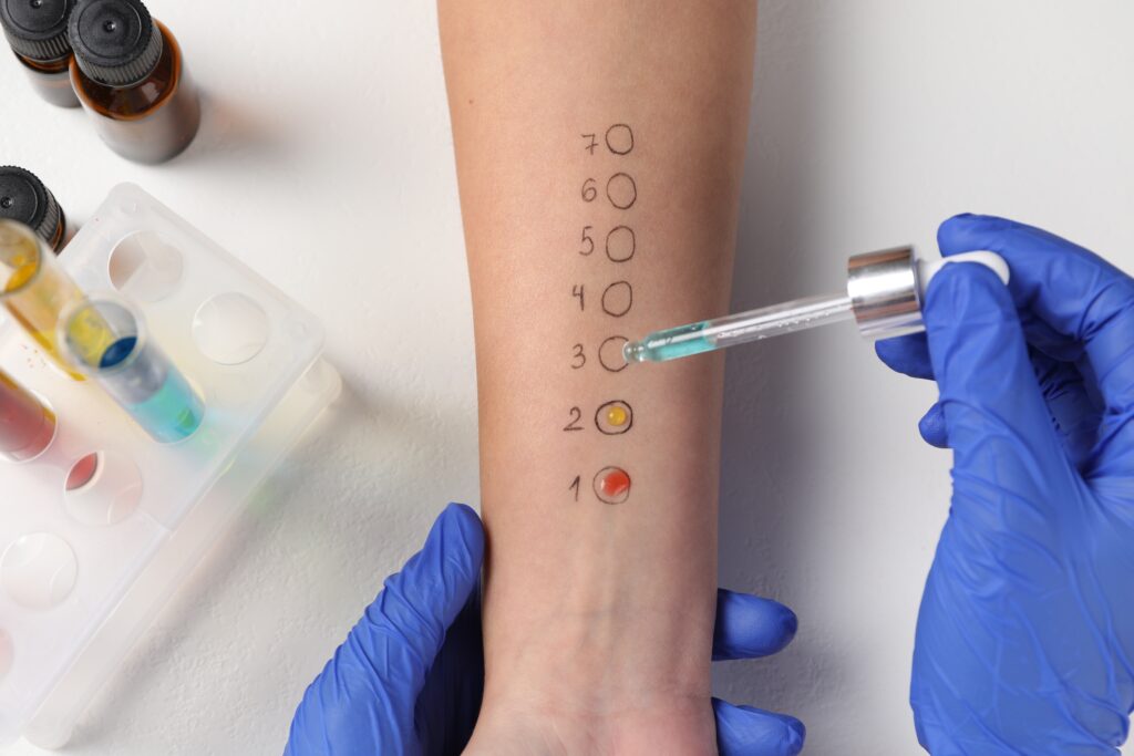 Skin Allergy Test: What To Expect And How They Work