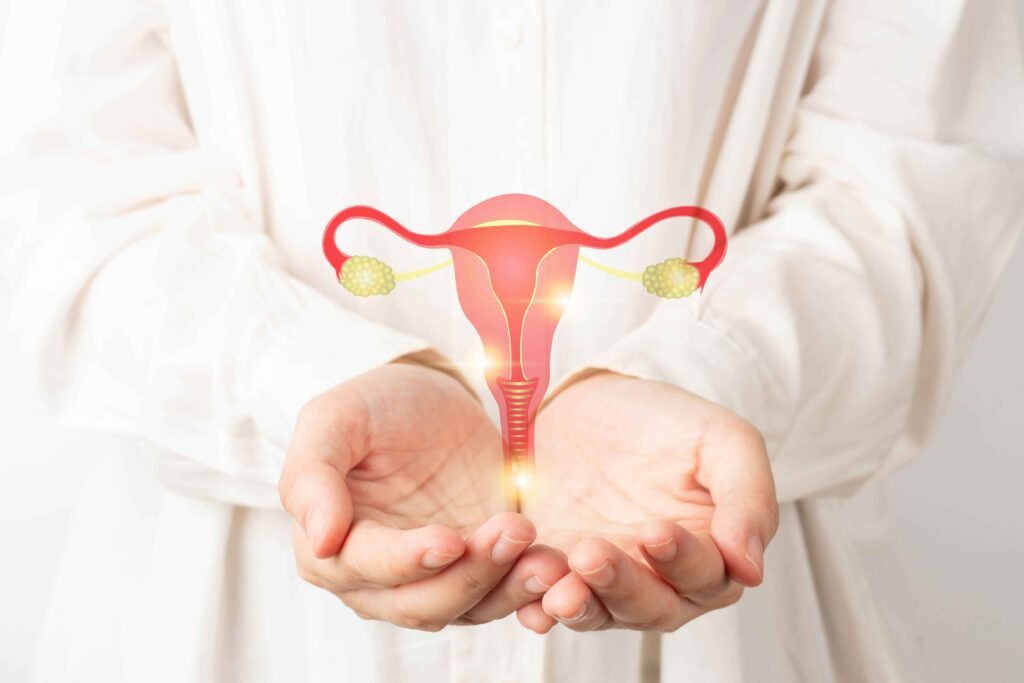 Polycystic Ovary Syndrome (PCOS) - Doral Health & Wellness NY