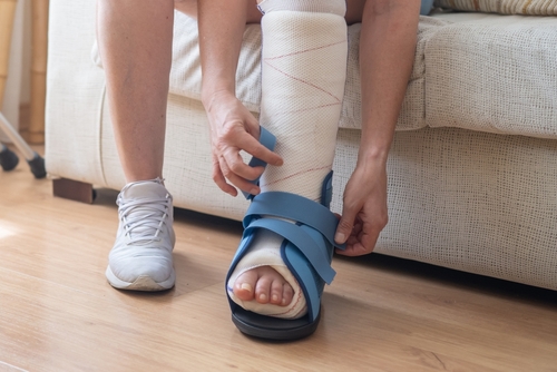 Metatarsal Fracture: Complete Recovery Timeline And Proven ...