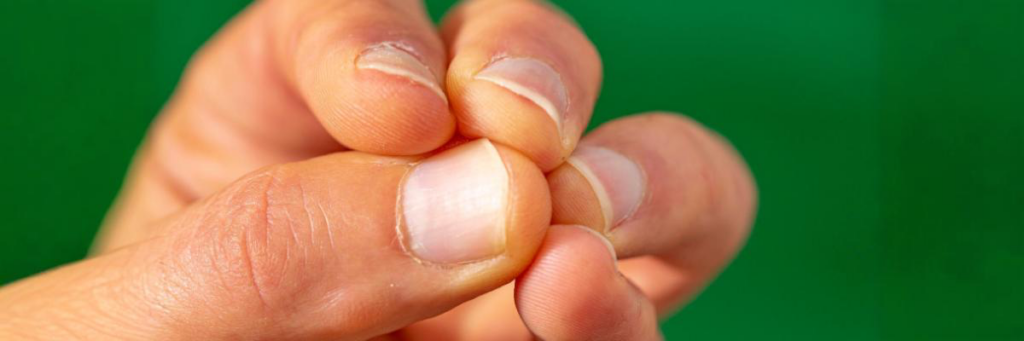 Nail Disorders: When To See A Dermatologist Vs. Podiatrist