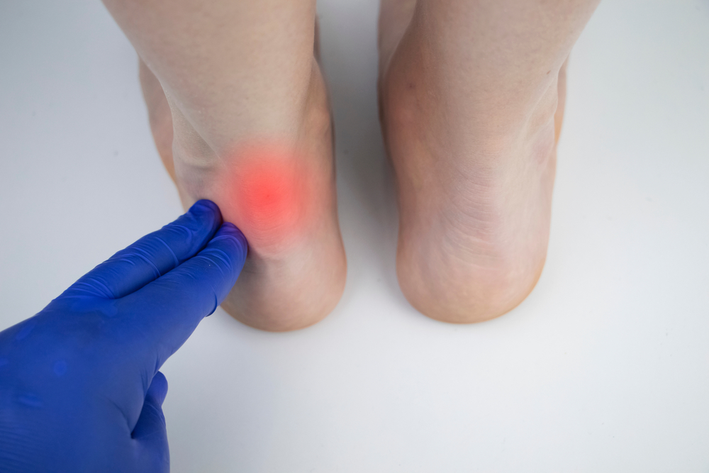 Big Toe Joint Fusion (First MTP Arthrodesis) - Doral Health & Wellness NY