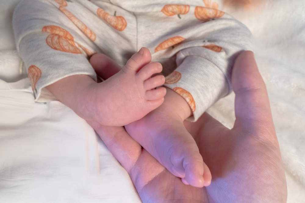 Understanding Vertical Talus: The Rare “Rocker-Bottom” Foot Deformity