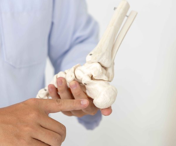 Plantar Fasciitis Surgery - Doral Health & Wellness NY